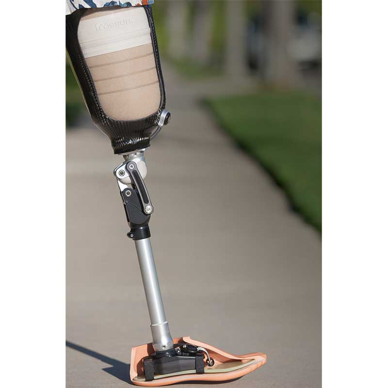 Elevated Vacuum Sockets - R. J. Rosenberg Orthopedic Lab, Inc.