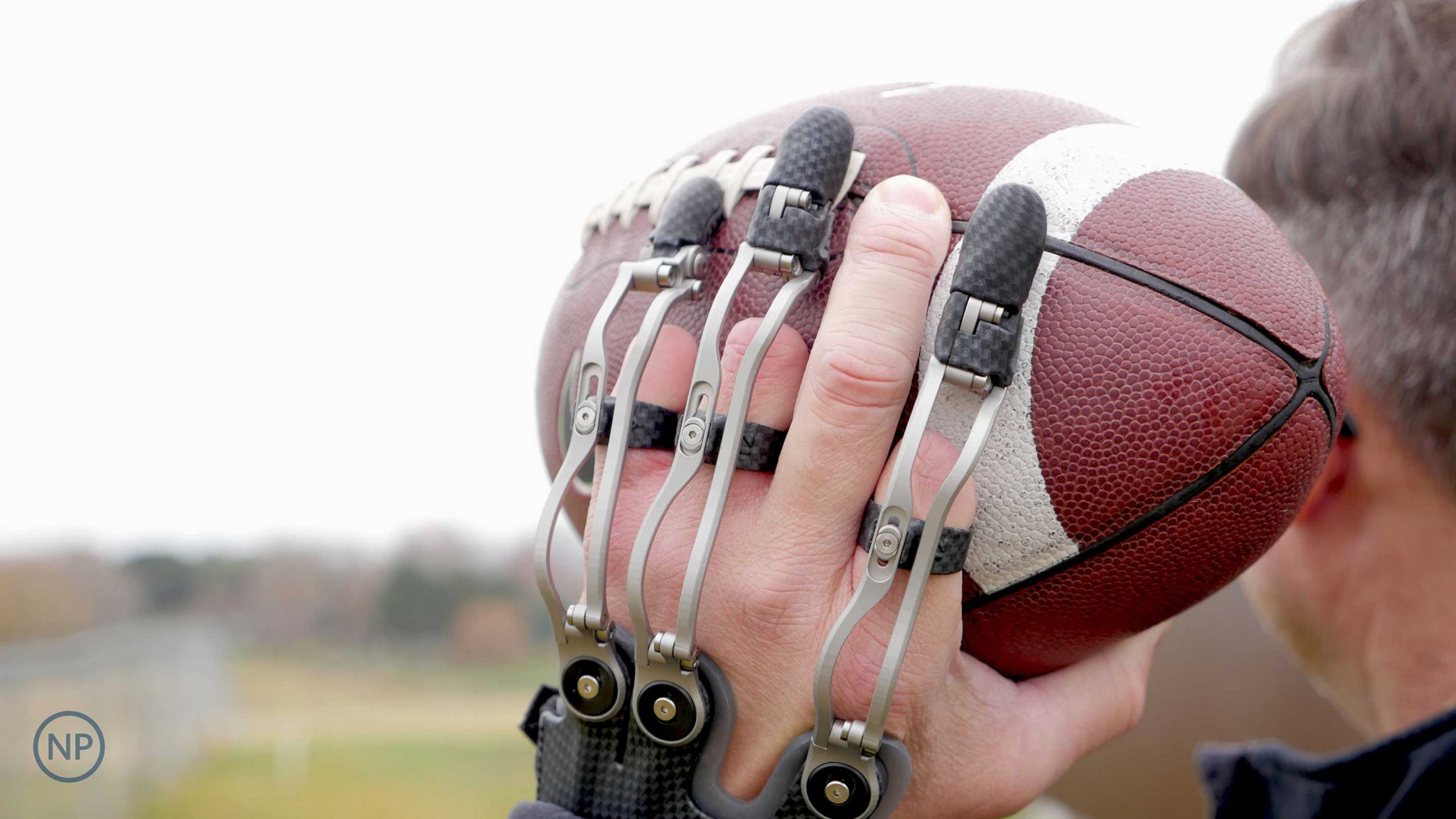 Partial Fingers/Partial Hand - R. J. Rosenberg Orthopedic Lab, Inc.