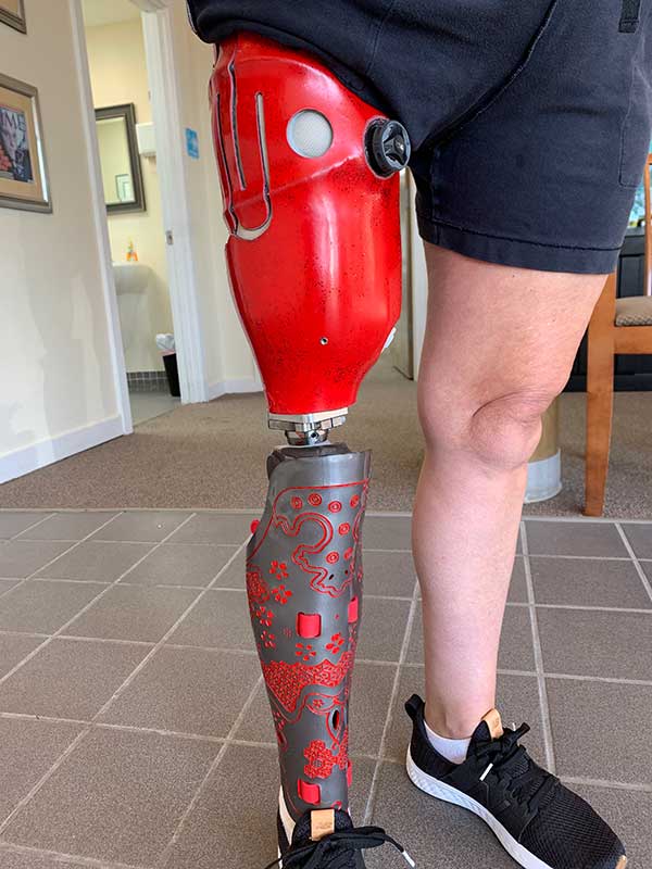 Adjustable Sockets Have Positive Results - RJ Rosenberg